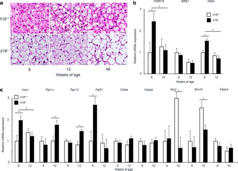 Bat In Il18−− Mice Spontaneously Accumulates Fat A To Analyze Lipid