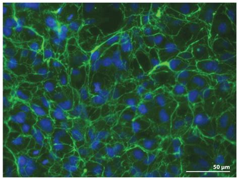 Assembly Of Fibronectin Extracellular Matrix Abstract Europe Pmc