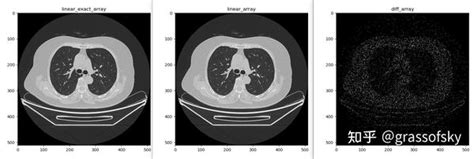 Dicom转换为灰度图的过程 知乎