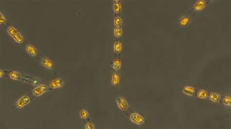 Brown Algae Under Microscope Labeled 2 100 Algae Microscope Stock