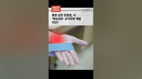 통증 심한 관절염이 핵심세포 공격하면 재발 차단 Youtube