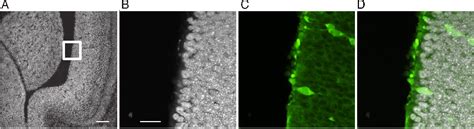 Figure 1 From Wnt Mediated Self Renewal Of Neural Stemprogenitor Cells
