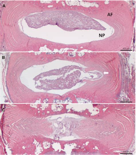 White Fibrocartilage Intervertebral Disc