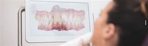 High Performance Intraoral Scanner PisÉo