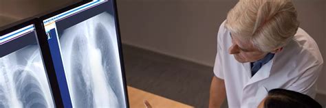 Radiography Software Philips