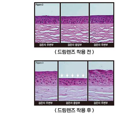 심안과 Since 1993