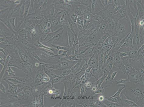Sw 1353 人软骨肉瘤细胞 Str鉴定正确 武汉普诺赛生命科技有限公司 您身边的细胞专家【官方网站】