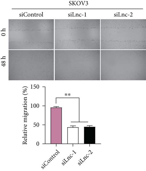 Downregulation Of LINC00958 Suppressed EOC Cell Migration And Invasion