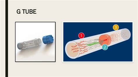 Pacbio Sequencing Principle Types Application Advantage And