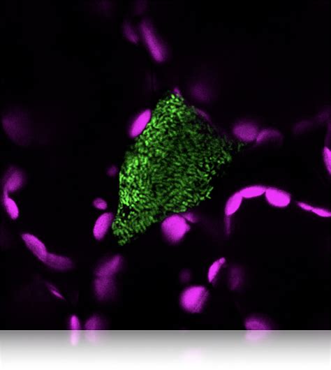 Host Microbe Interactions Plant Biology Scoopit