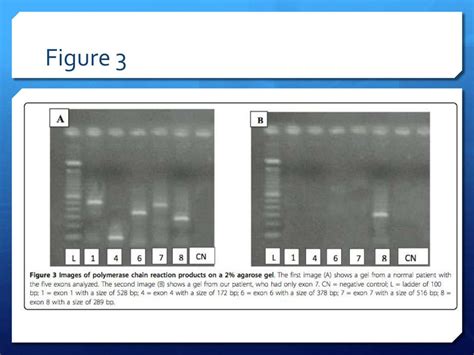 Ppt Challenges In Clinical And Laboratory Diagnosis Of Androgen