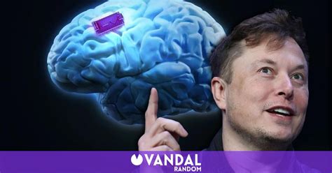 Elon Musk Anuncia Que Neuralink Ha Implantado Por Primera Vez Un Chip