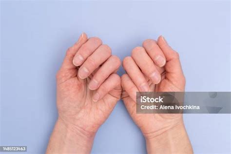 자연스러운 손톱을 가진 두 여성의 손을 클로즈업하고 파란색 배경에 자란 큐티클 손과 손톱 관리 손톱에 대한 스톡 사진 및 기타 이미지 Istock