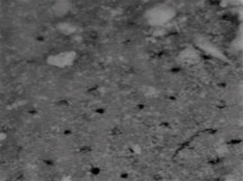 Scanning Electron Micrograph Sem Of Dentin Surface Following Caries Download Scientific