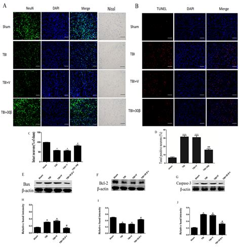 Tbi Induced Neuronal Apoptosis Was Decreased By β Carotene Treatment 7