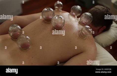 Cupping Therapy Man Stock Videos And Footage Hd And 4k Video Clips Alamy