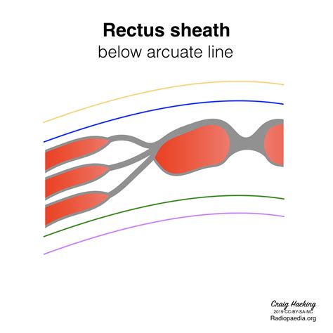 Radiopaedia Drawing Rectus Sheath Below Arcuate Line No Labels Anatomytool