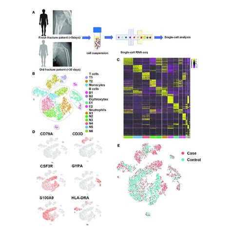 Single Cell Profiling Of Human Fracture Tissue Cells A Schematic Download Scientific