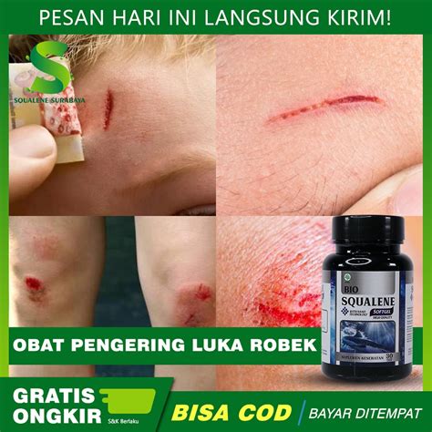 Jual Obat Pengering Luka Robek Obat Luka Jahitan Robek Dan Bernanah