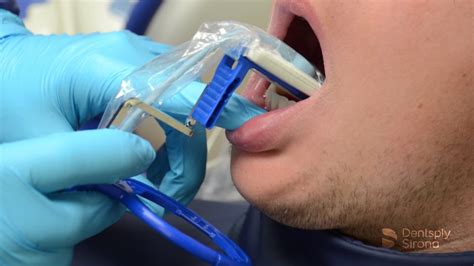 Rinn Xcp Short Arm Anterior Placement Dentsply Sirona Youtube