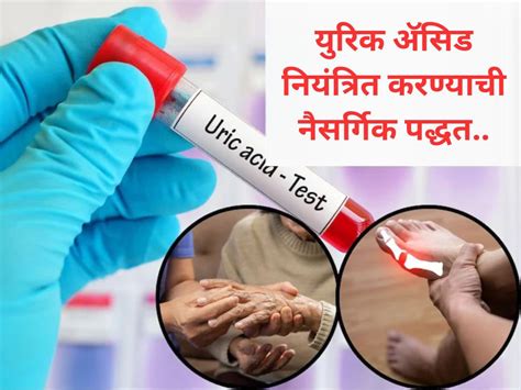 औषधाविना एका आठवड्यात कमी होईल युरिक अ‍ॅसिड फक्त रोज करा ही 4 कामं
