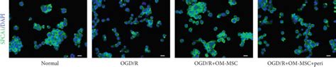 Om Mscs Reduced The Ga Stress Response By Regulating The Pi3kaktmtor