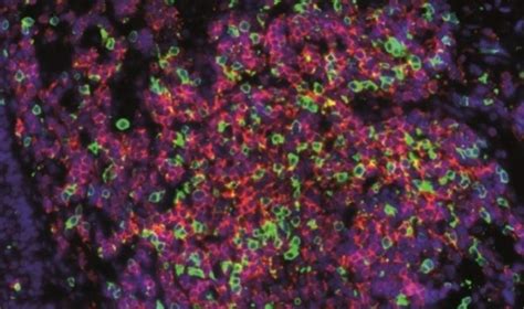 HIV Wakes Up Only Once A Week Under Treatment Asian Scientist Magazine