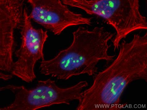 Nat10 Antibody 82585 1 Rr Proteintech