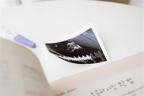 아기 초음파사진 보는법 태아 초음파 잘찍는 팁 네이버 블로그