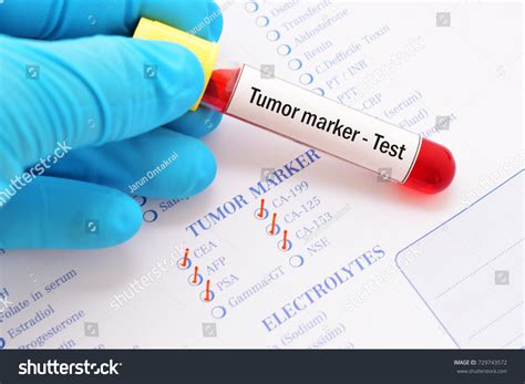 Blood Sample Requisition Form Tumor Marker Stock Photo Edit Now