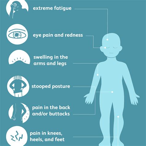 Juvenile Ankylosing Spondylitis Symptoms Causes Diagnosis And Treatment
