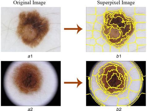 Illustrations Of The Superpixel Segmentation Results After Slic The