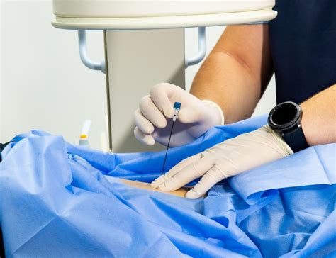 Facet Joint Injections Leading Spine Surgeon Los Angeles