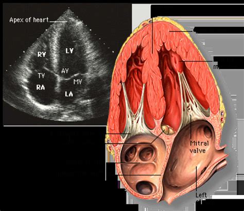 Making Sense Of An Echocardiogram Report For Gps — Cardiology Institute