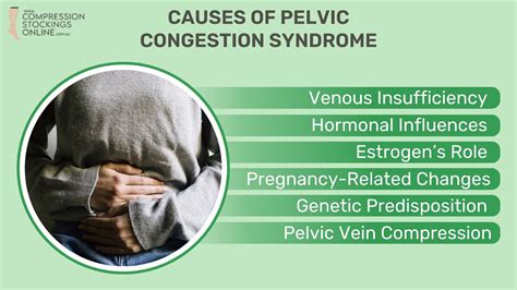 What Is Pelvic Congestion Syndrome Causes And Treatment Compression