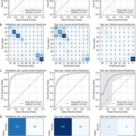 Roc Curves And Confusion Matrices For The Psma Rads Classification Task