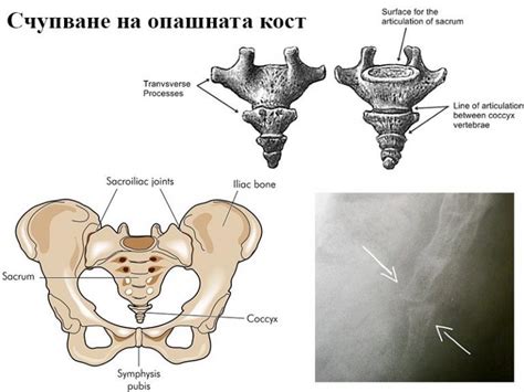 Счупване на опашната кост причини симптоми лечение Arsmedica Bg