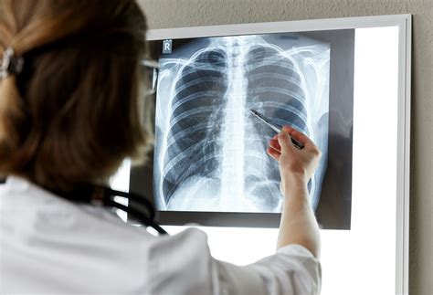 Transplant Institute Northwell Health