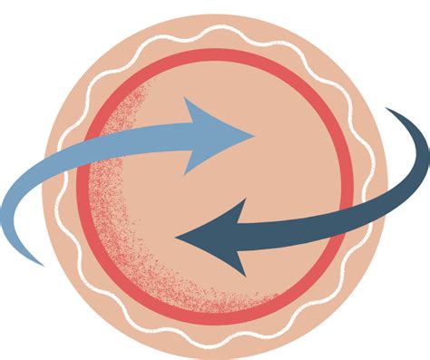 Pgt A Plus Igenomix With Science On Your Side