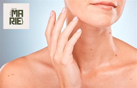 Tratamento Para Rejuvenescimento Das Mãos Colo Ou Pescoço Marie