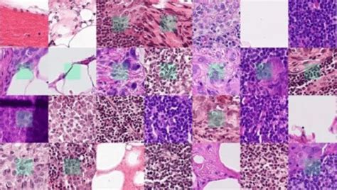 Image Patches From The Pcam Dataset Download Scientific Diagram