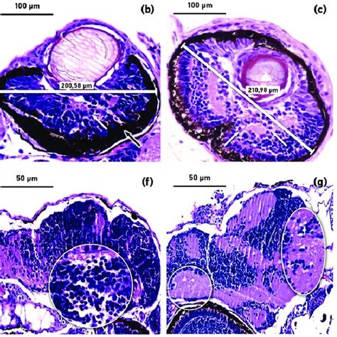 The Effects Of Ionizing Radiation Of The Eye And The Developing Central