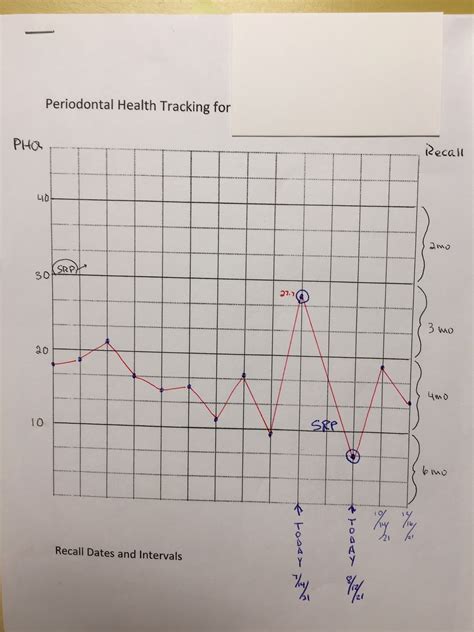 Chart Examples