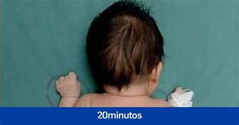 Extirpan A Un Bebé Chino Un Pene De La Espalda Con El Que Había Nacido
