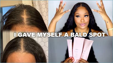 How I Gave Myself A Bald Spot And Grew It Back Fabulous Bre Youtube