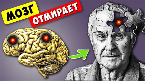 7 Признаков того, что Ваш МОЗГ ОТМИРАЕТ! 90% даже НЕ Догадываются об ...