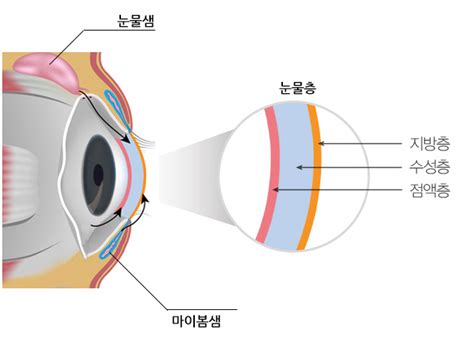 우리안과
