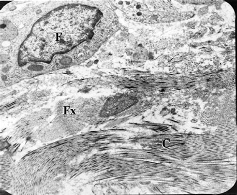 An Electron Micrograph Of The Gingiva From Emd Site A Rounded