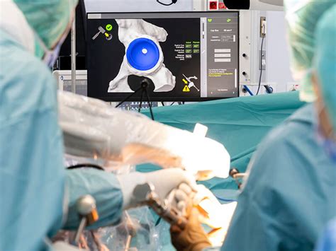 robotics navigation and the tech behind orthopedics growing digital