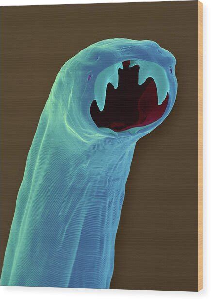 Cat Hookworm Ancylostoma Braziliense Photograph By Dennis Kunkel